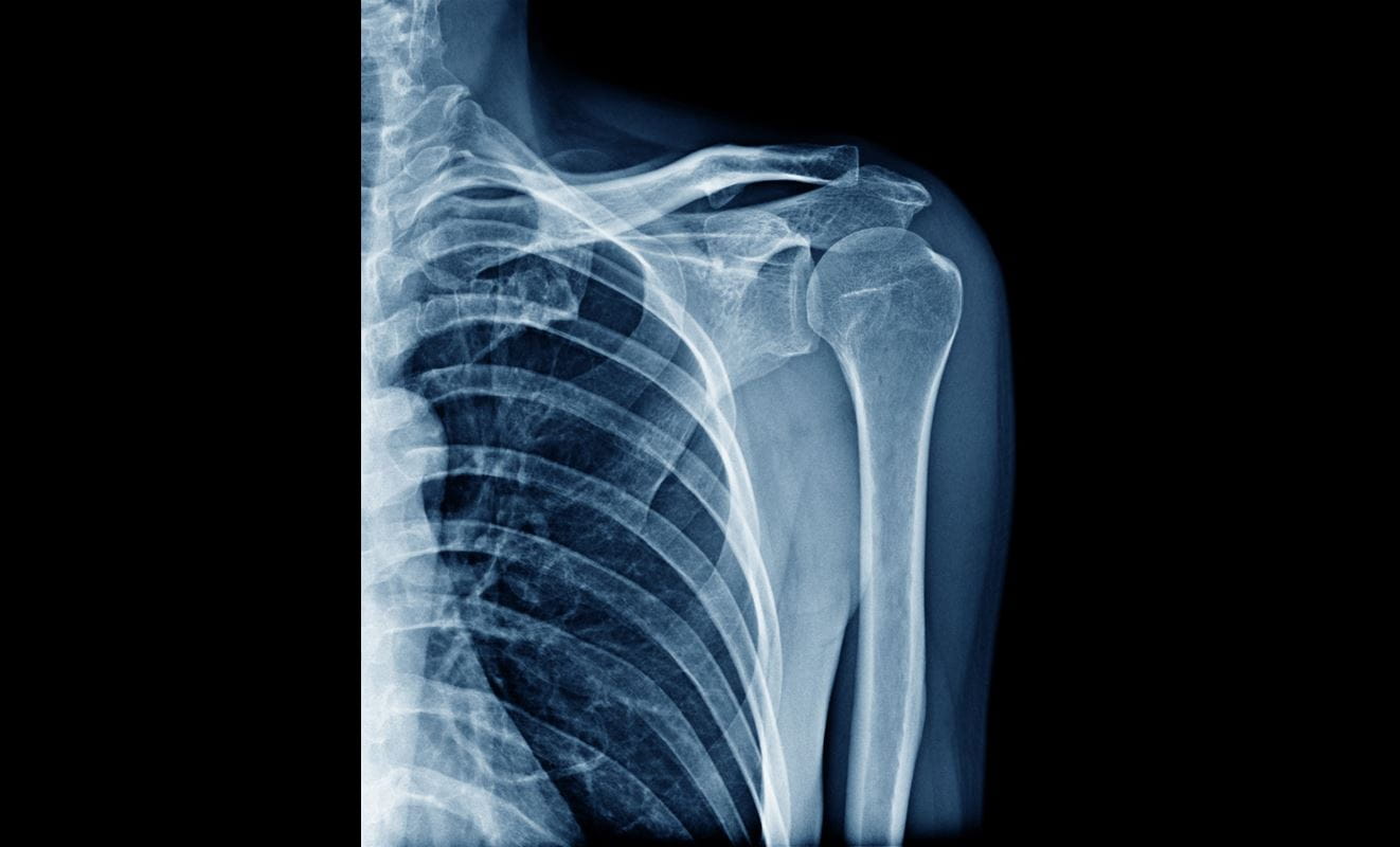 Healthcare - Center for Applied Artificial Intelligence | Chicago Booth